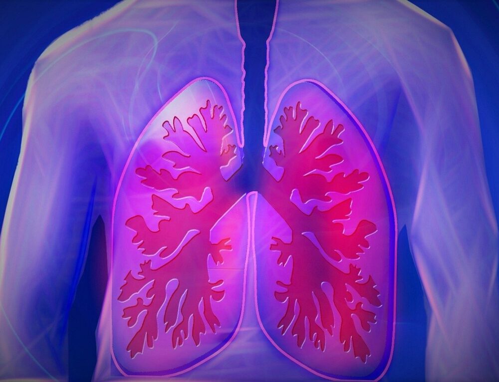 The RACI Chart Simply Explained — ISSSP for Lean Six Sigma